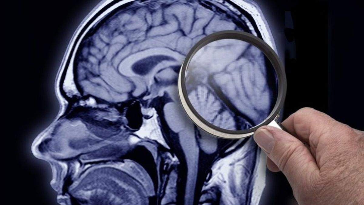 Detectan alteraciones mitocondriales clave en el daño cerebral por ...