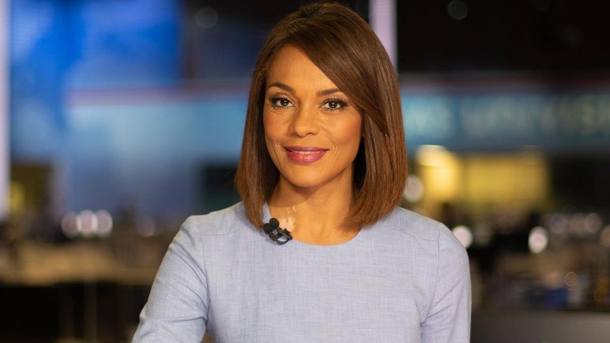 Ilia Calderón cuenta como lidia con el vitíligo