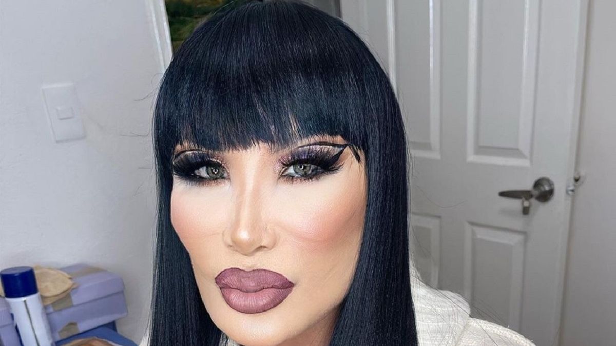 Las últimas cirugías en el rostro de Lyn May y su increíble antes y después