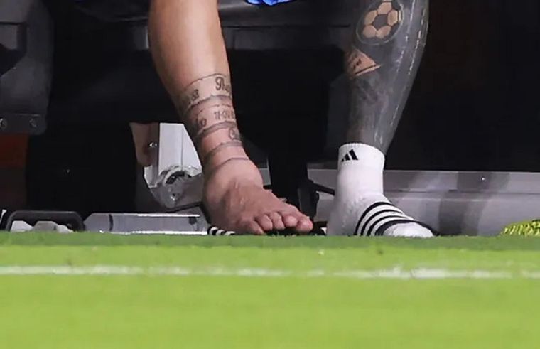 El diagnóstico de un especialista sobre la impactante lesión de Messi
