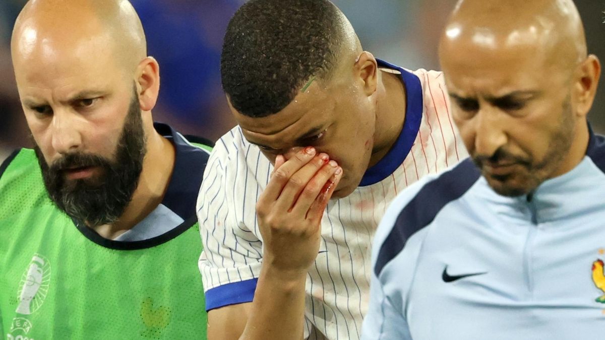 Tremendo golpe: la impactante imagen de la nariz de Mbappé que preocupa ...