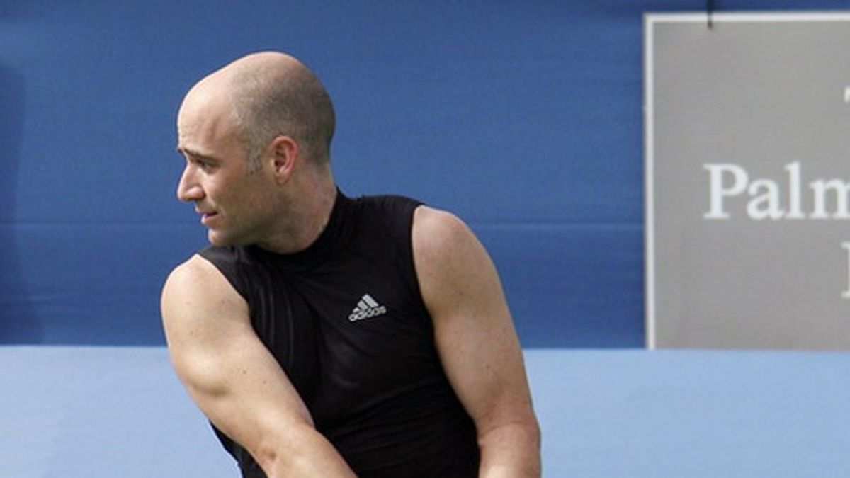 Gómez considera falta respeto revelación de Agassi sobre peluca