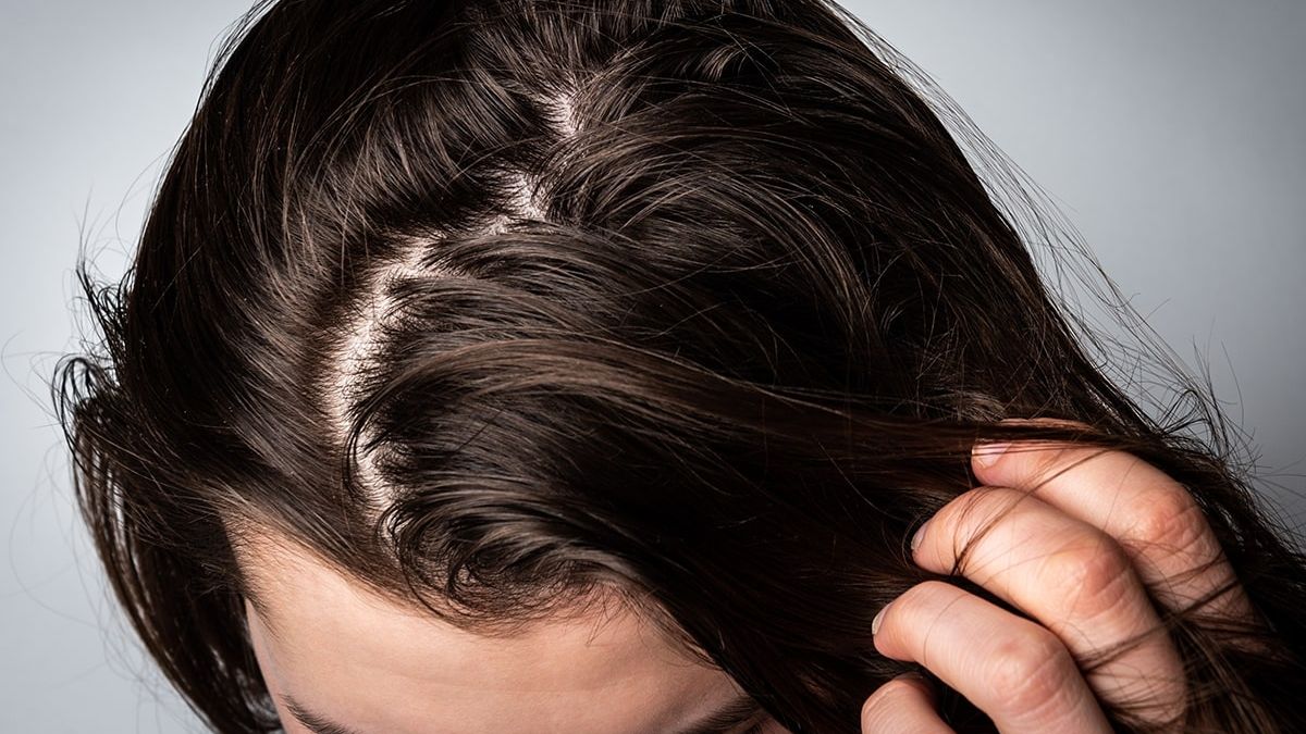 6 trucos para controlar el cabello graso sin ir a la peluquería