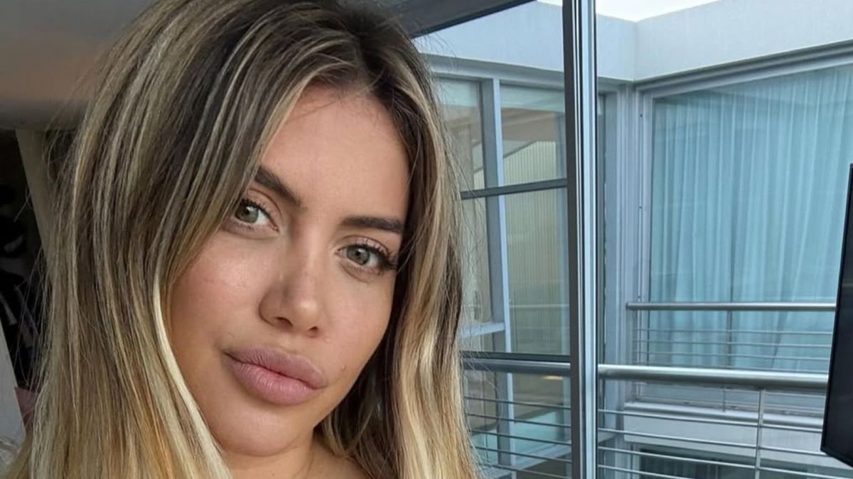 Así quedó Wanda Nara tras las cirugías estéticas que se hizo: las fotos
